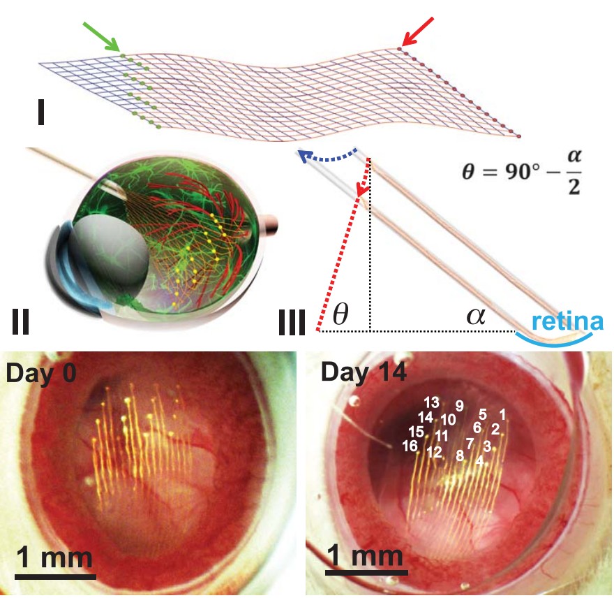 A method for single-neuron chronic recording from the retina in awake ...