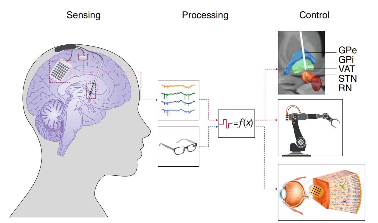 Precision electronic medicine in the brain | i-BRAIN Research Group